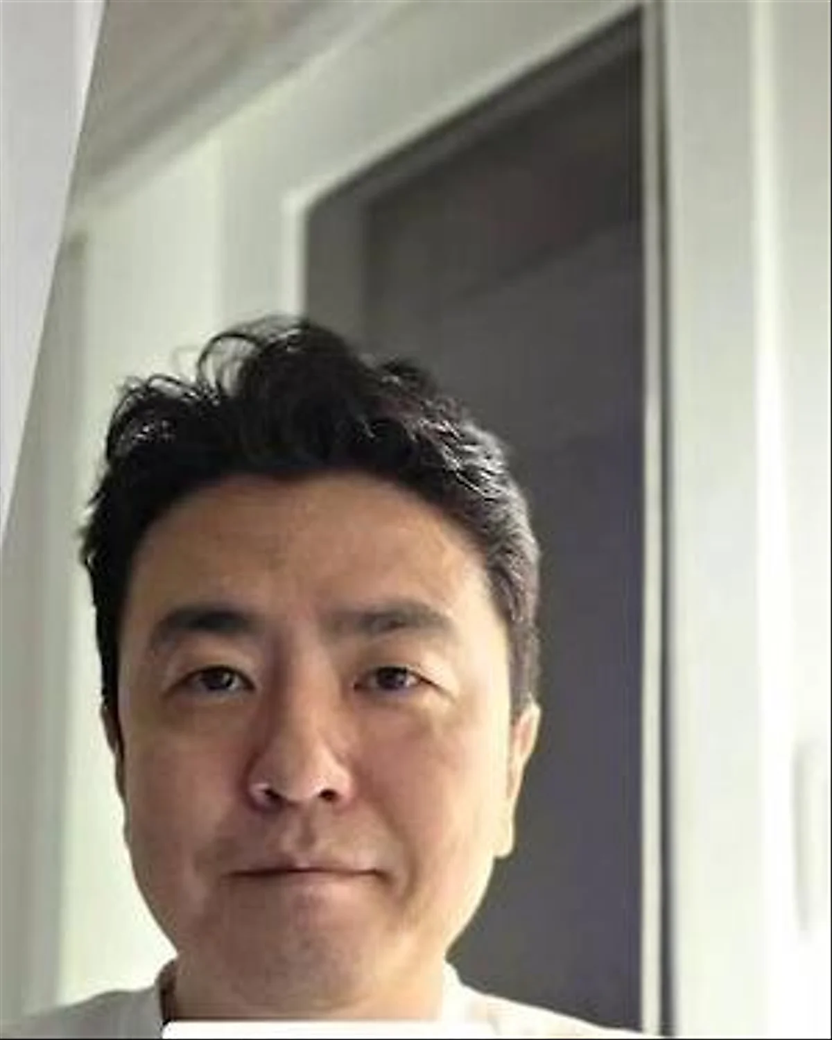Choi Dong-seok Reveals Sharper Nose Profile Following Divorce from Ji ...